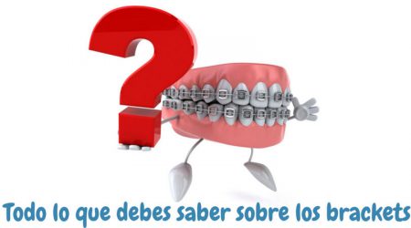Todo lo que debes saber sobre los brackets - Ortodoncia González del Río